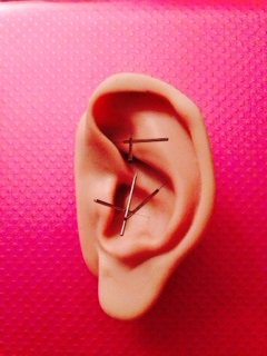 NADA Treatment & Training | Catonsville, MD