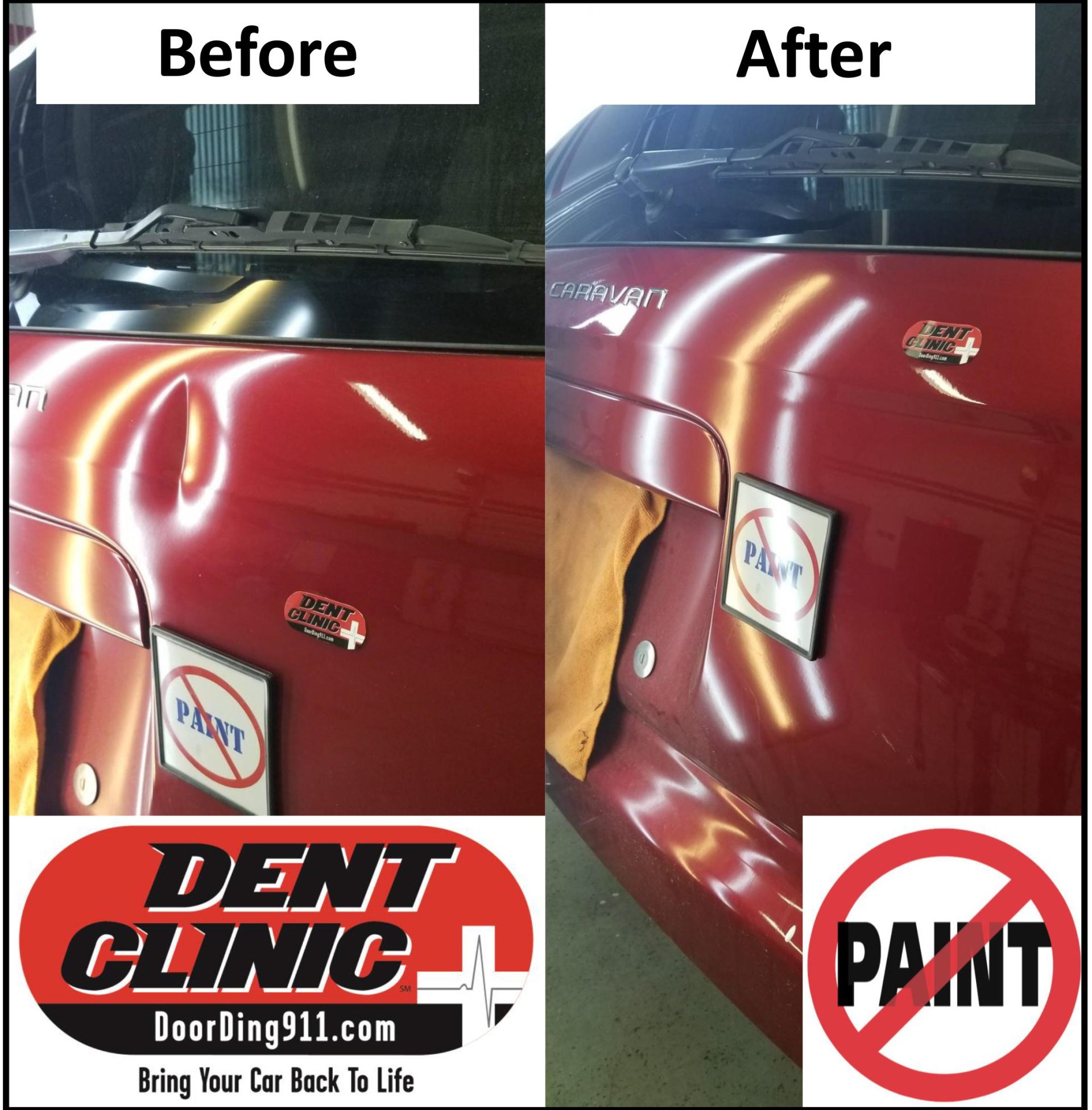 Paintless Dent Repair | Dent Clinic