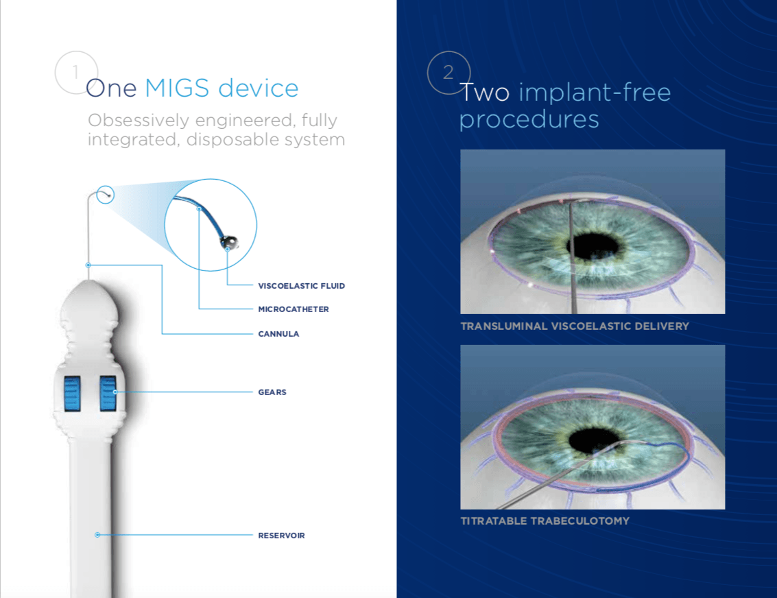 Glaucoma | Kahook Dual Blade | Louisville, KY