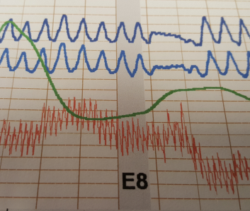 How Does Polygraph Work? | Polygraph Test Cleveland OH