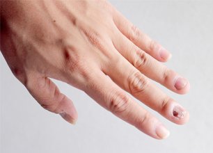 Wabash Valley Infectious Diseases | Terre Haute, IN