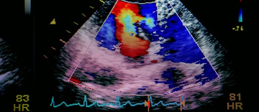 Cardio Testing | Heart Treatments | Baltimore, MD