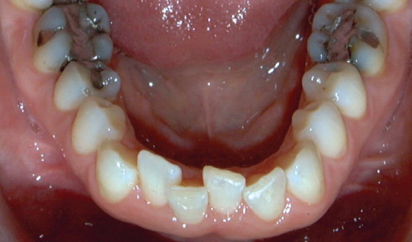 Brent P. Collins DDS, MS | Common Teeth Issues | Maryville, TN