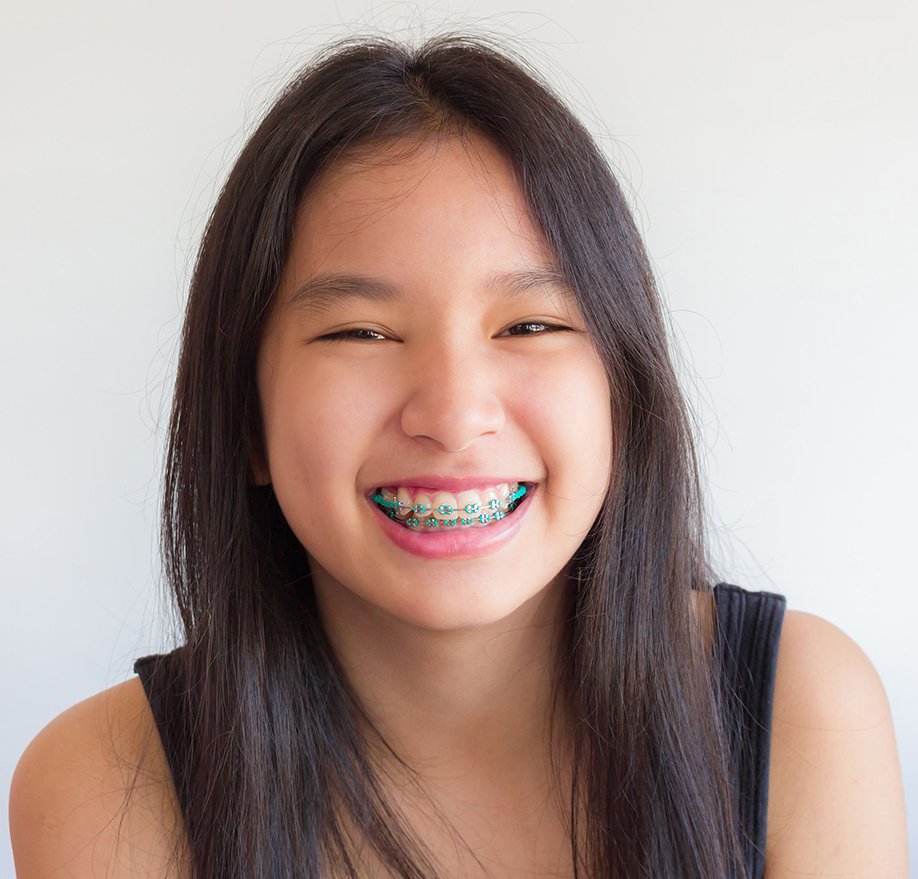 Metal Braces | Clear Aligners | Maryville, TN