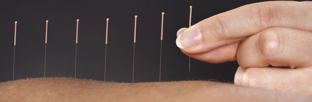 Acupuncture | Traditional Treatment | Westminster, MD