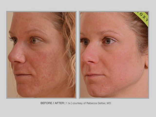East End Plastic Surgery & Laser Center Photo Gallery Riverhead