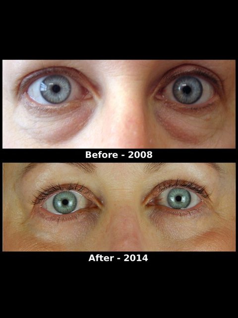 East End Plastic Surgery & Laser Center Photo Gallery Riverhead