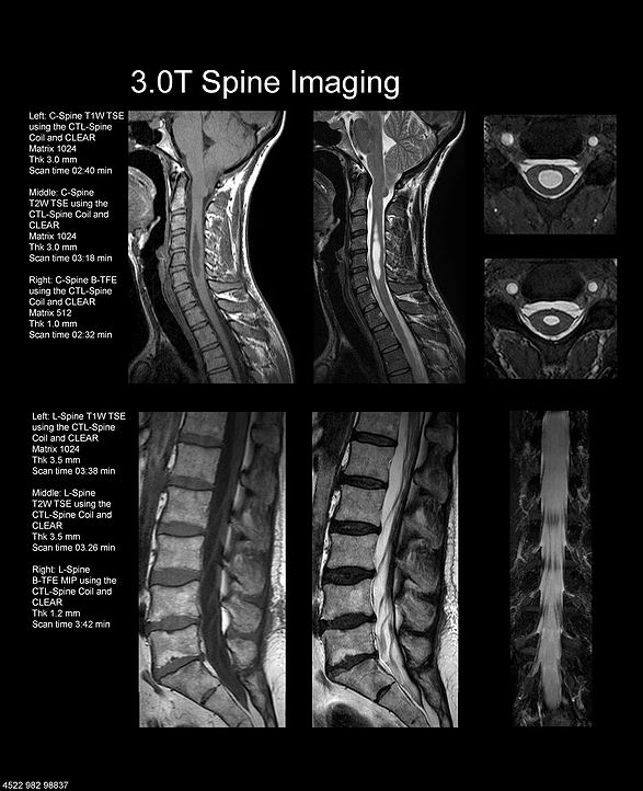 3T Images | High-Field MRI | Tulsa, OK